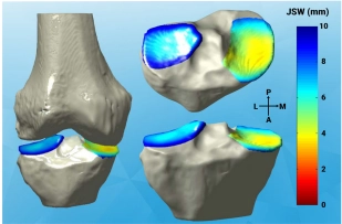New Case Study Showcases Advancements in Measurement of Joint Space ...