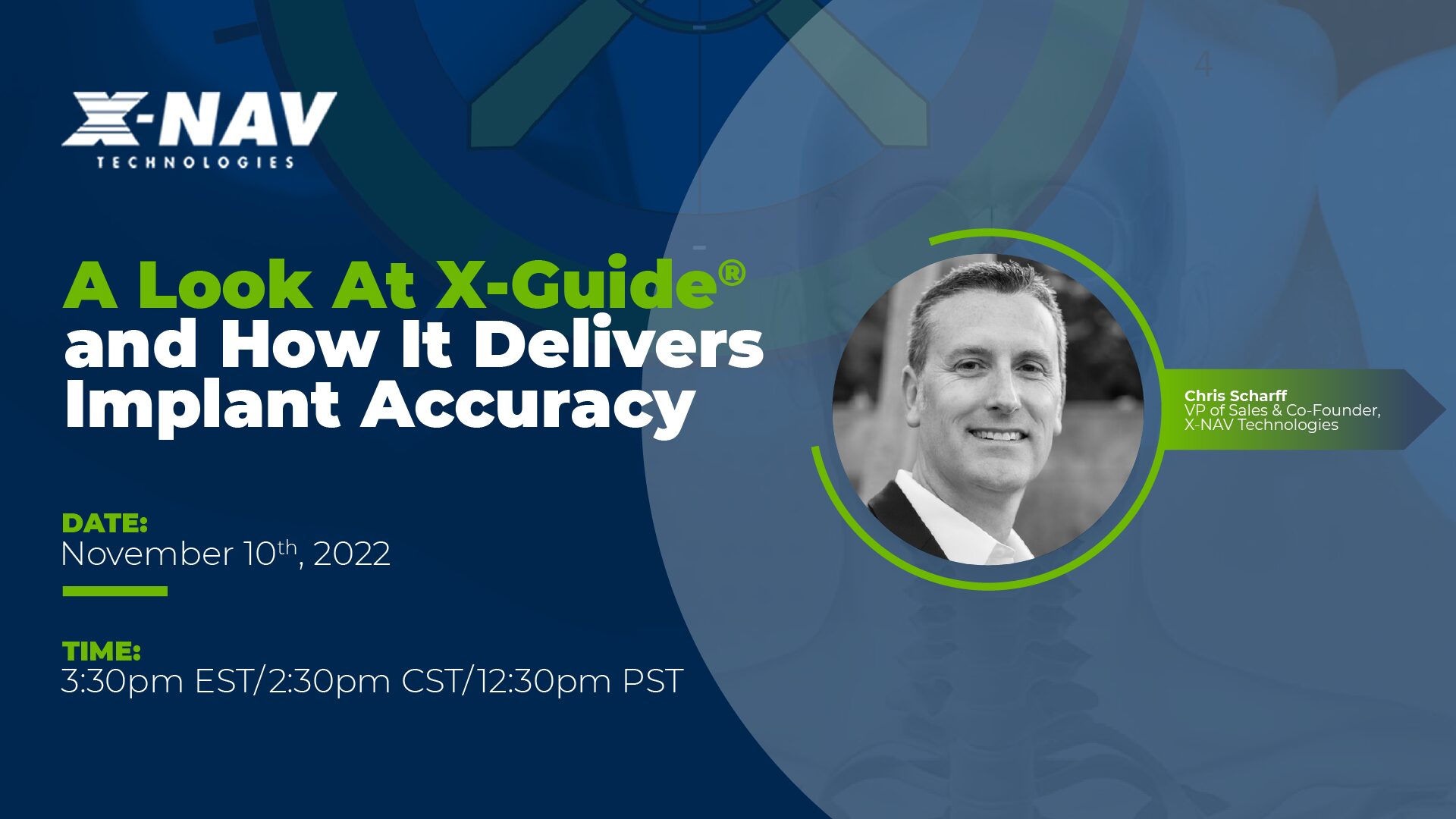 A Look At X-Guide®️ and How It Delivers Implant Accuracy - MarketScale