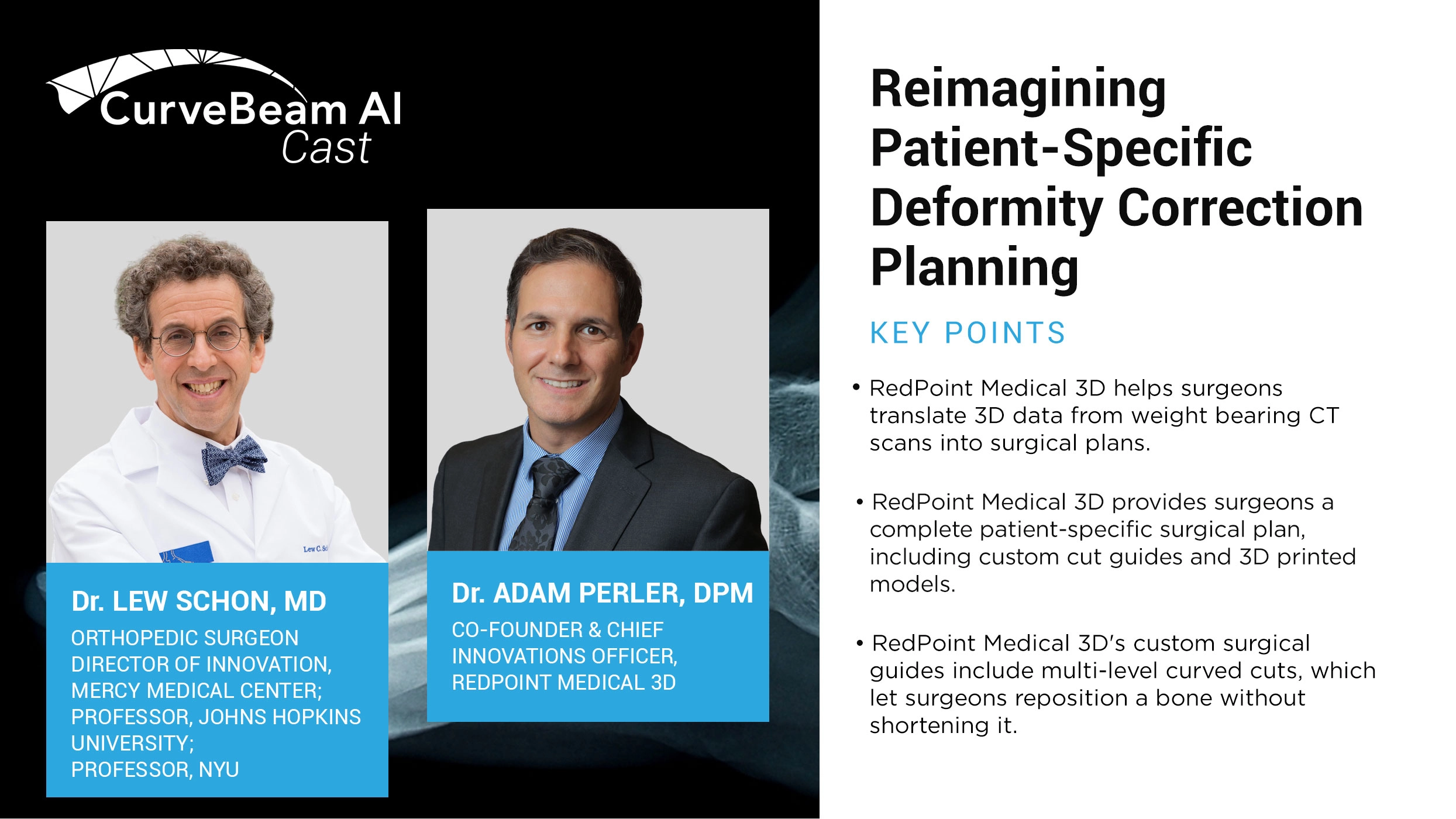 CurveBeam AI Cast - Reimaging Patient-Specific Deformity Correction ...